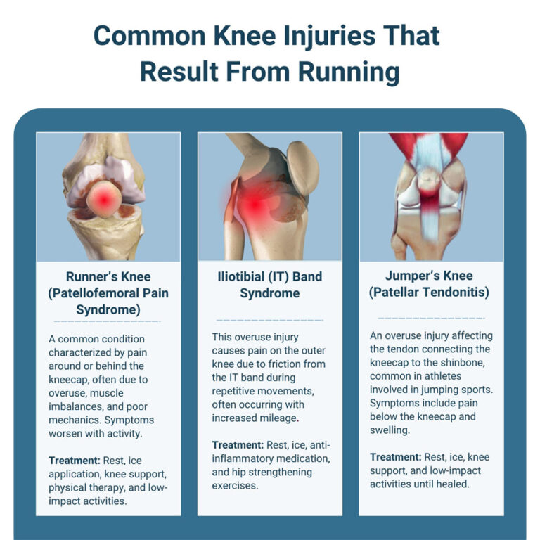 What Are Common Knee Injuries from Running? | Sports Injury & Pain Management Clinic of NYC