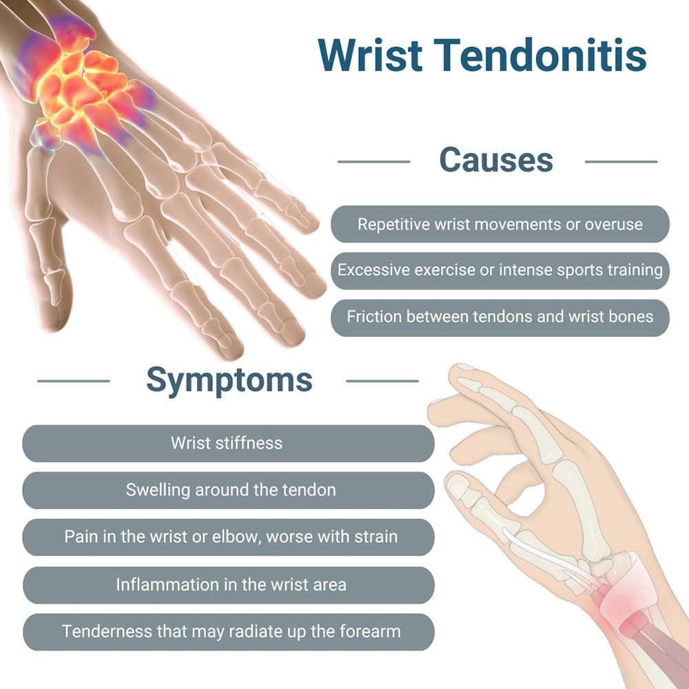 Wrist Tendonitis Symptoms